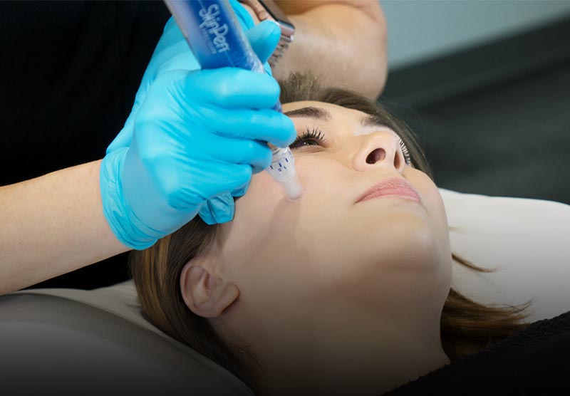 SkinPen Microneedling - Sublime MediSpa