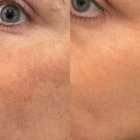 Sublime MediSpa: Ottawa’s best Skin Clinic