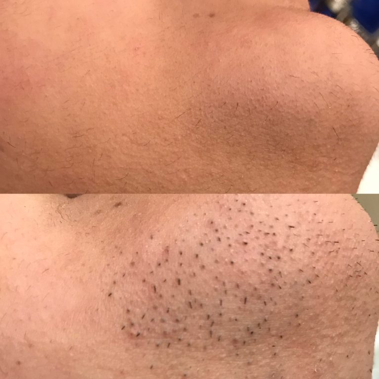 Sublime MediSpa: Ottawa’s best Skin Clinic